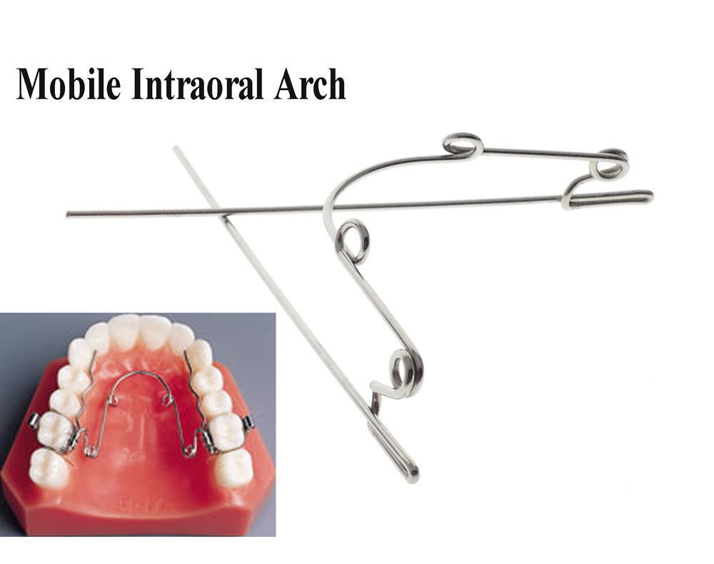 Mobile Intraoral Arch (Arch Quad Helix ), 1 Piece / Pack (Unit)