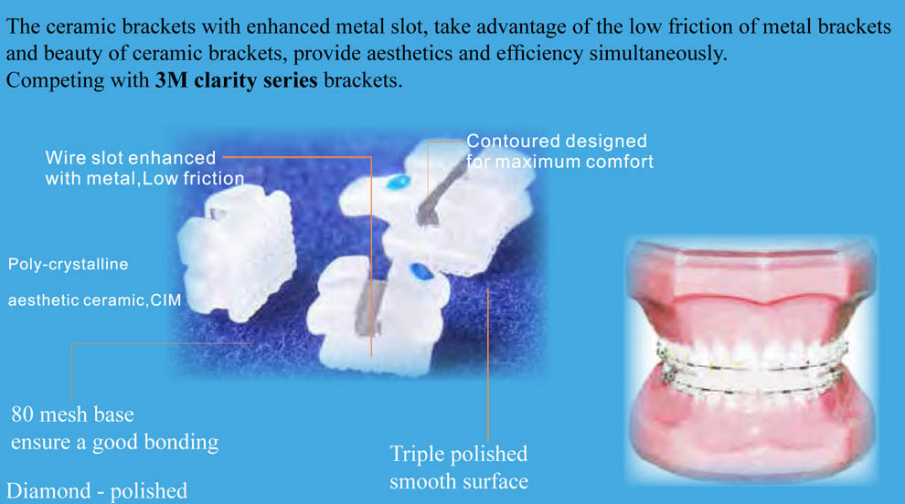Clear Ceramic Bracket with Metal Slot, 5-5, upper and lower, 20 Pcs /Case