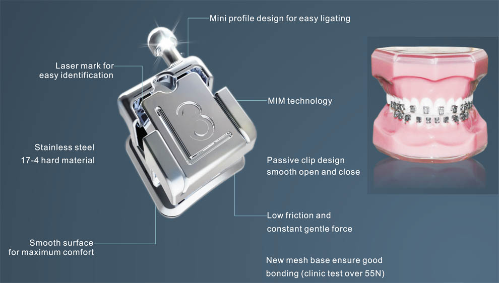 Smart Passive Slide Self-Ligating Bracket (Include ligating instrument ...