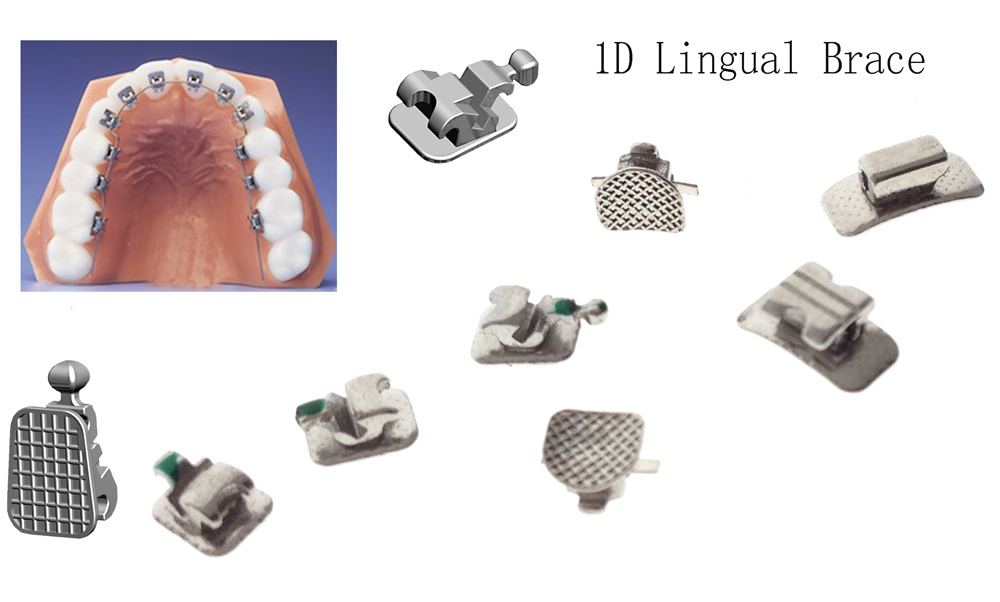 1D Metal Lingual Bracket , 7-7 /28 Pcs (Unit)